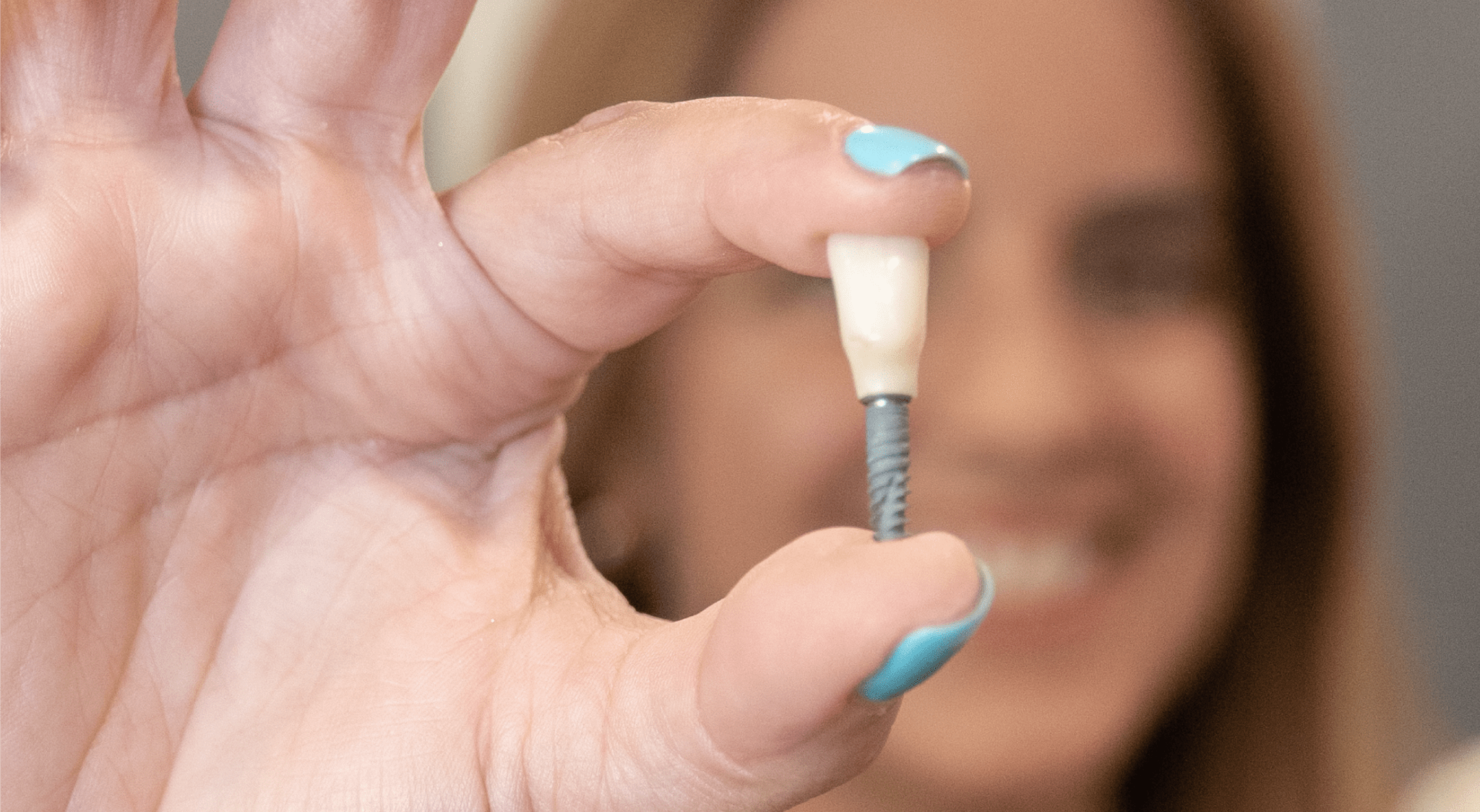 Dental Implants Coral Springs & Parkland FL - Dental Wellness Team